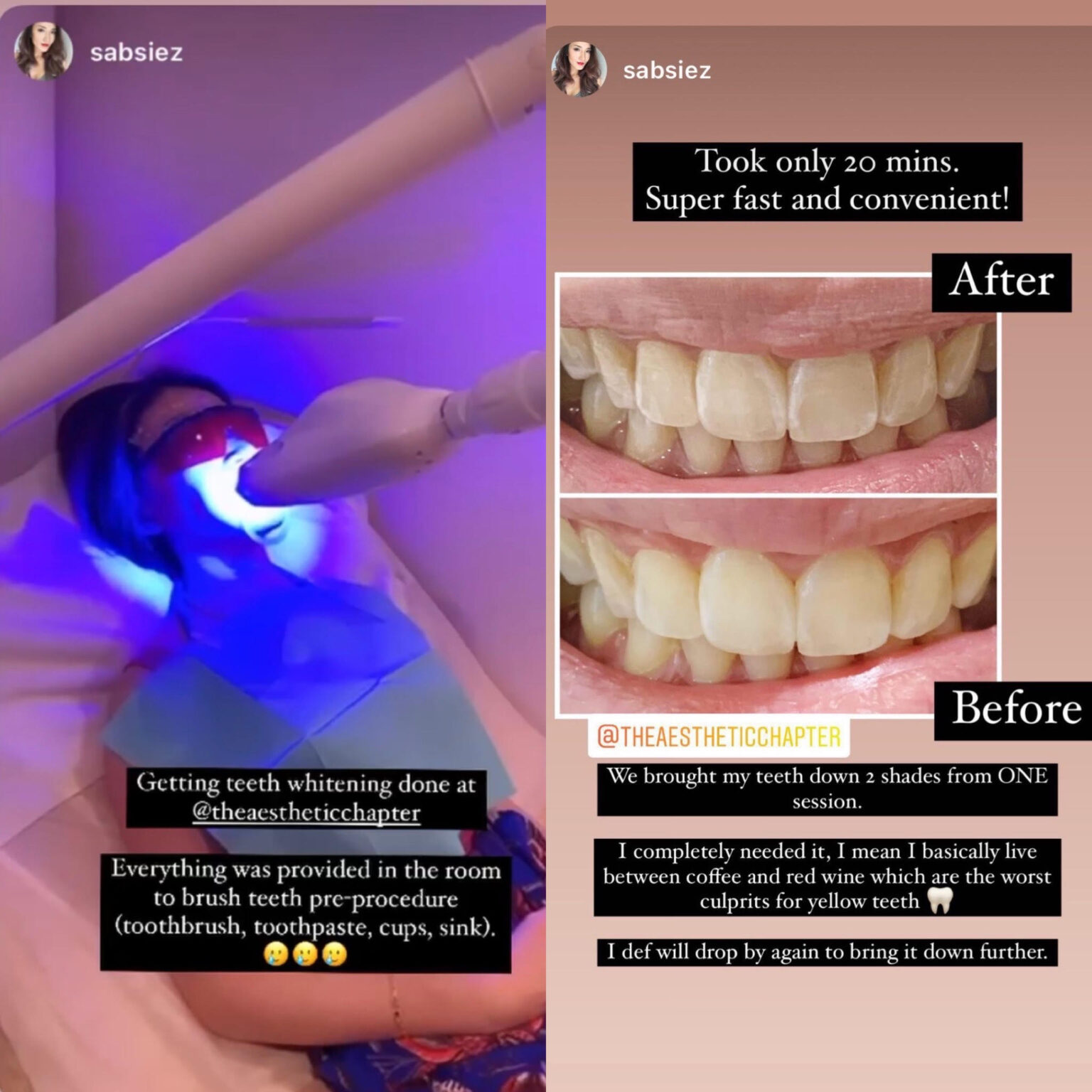 Japan Teeth Whitening (No1 Brand In Japan)