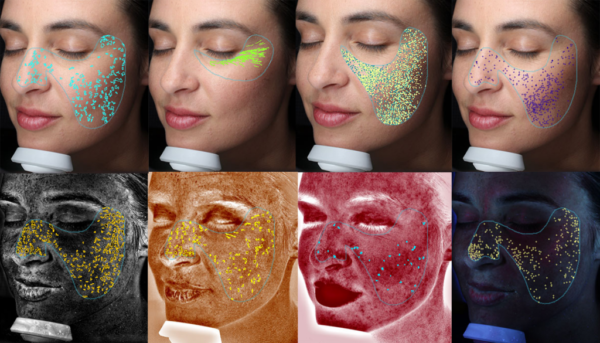 Visia Skin Analysis - The Aesthetic Chapter Singapore