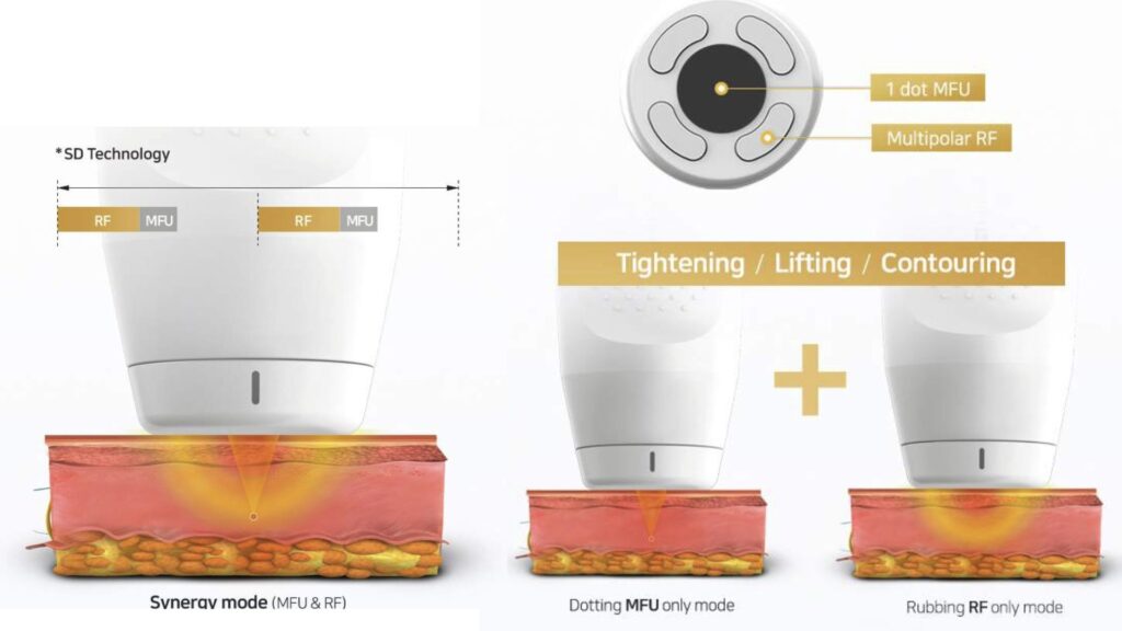 New Doublo HIFU | The Aesthetic Chapter Singapore