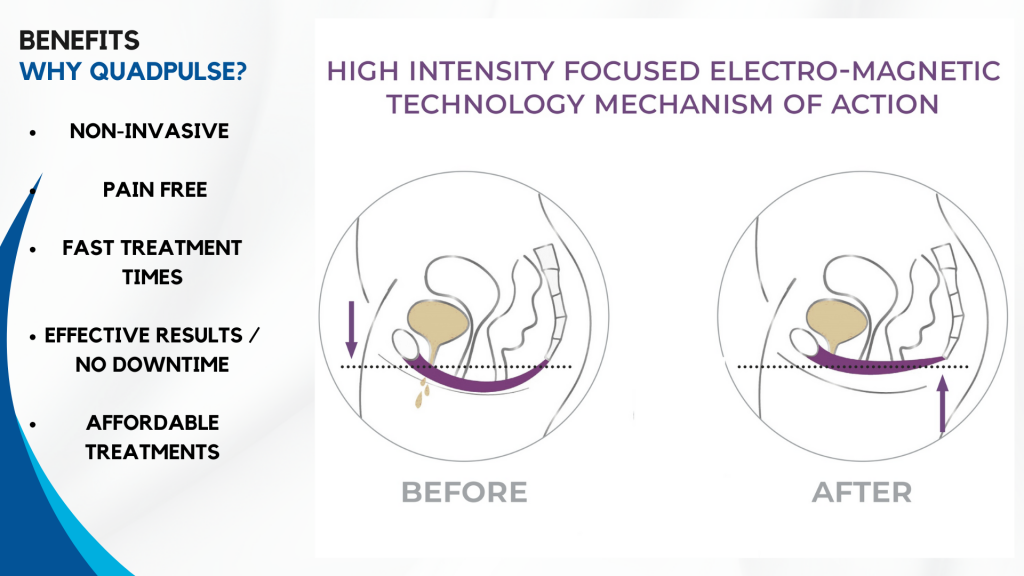 QuadPulse Pelvic Chair - The Aesthetic Chapter Singapore